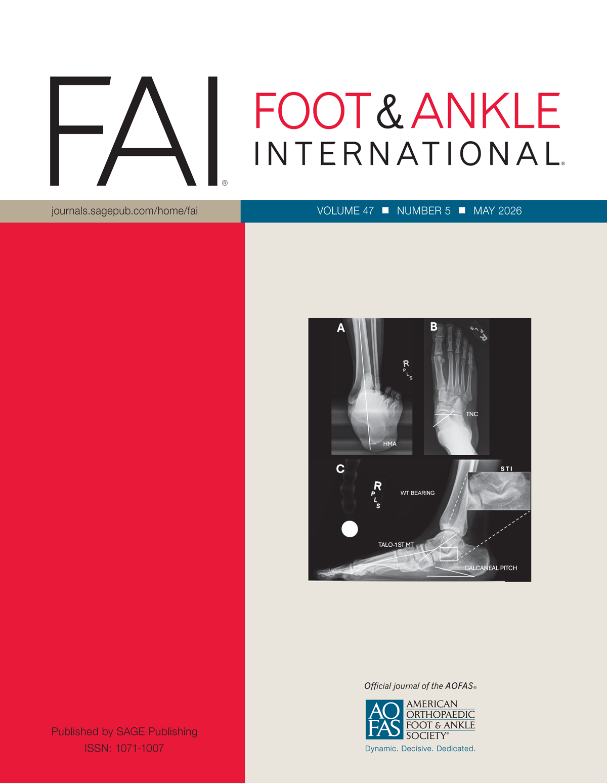 Ankle Arthroscopy: Technique and Indications - David Drez, James F ...